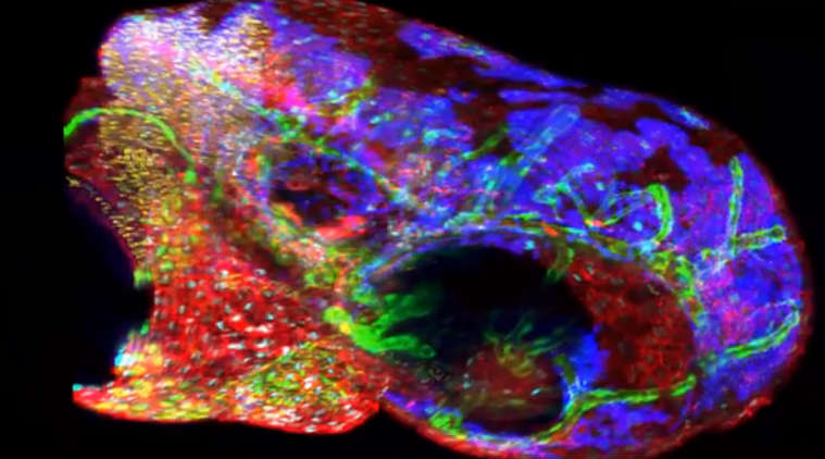 New 5D technique may help diagnose diseases from cell phone images ...