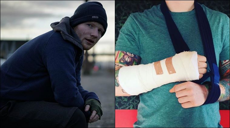 Ed Sheeran’s arm injury to affect his India concert? | Music News - The ...