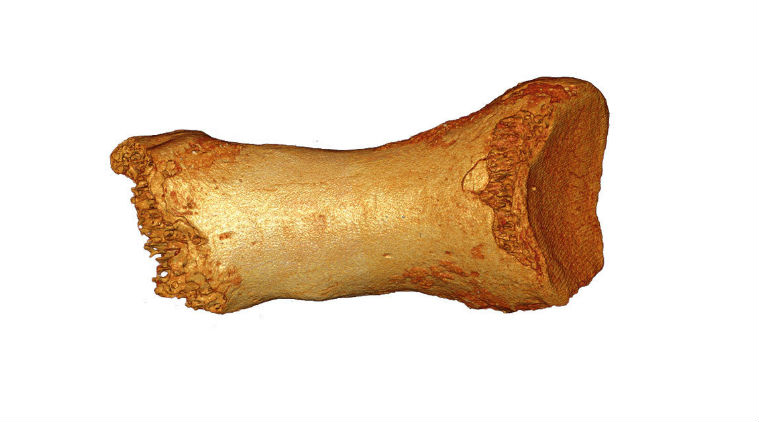 Modern traits can be traced back to Neanderthal DNA