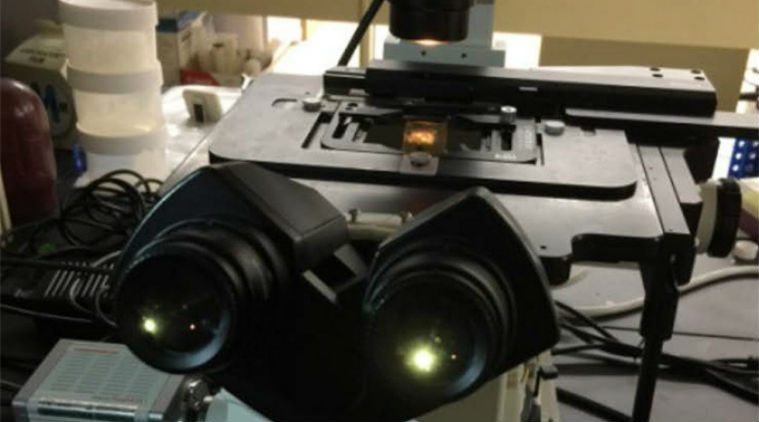 Micro-thermometer can record tiny temperature changes: Study ...