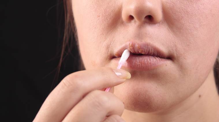 Is your chapped lip bothering you? Know why it could be happening ...