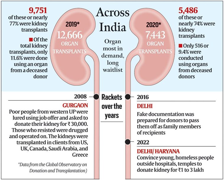 Explained: Why kidney rackets thrive | Explained News - The Indian Express