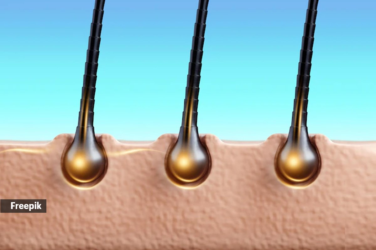 All about sebaceous filaments: What they are and how to reduce them | Life-style News - The ...