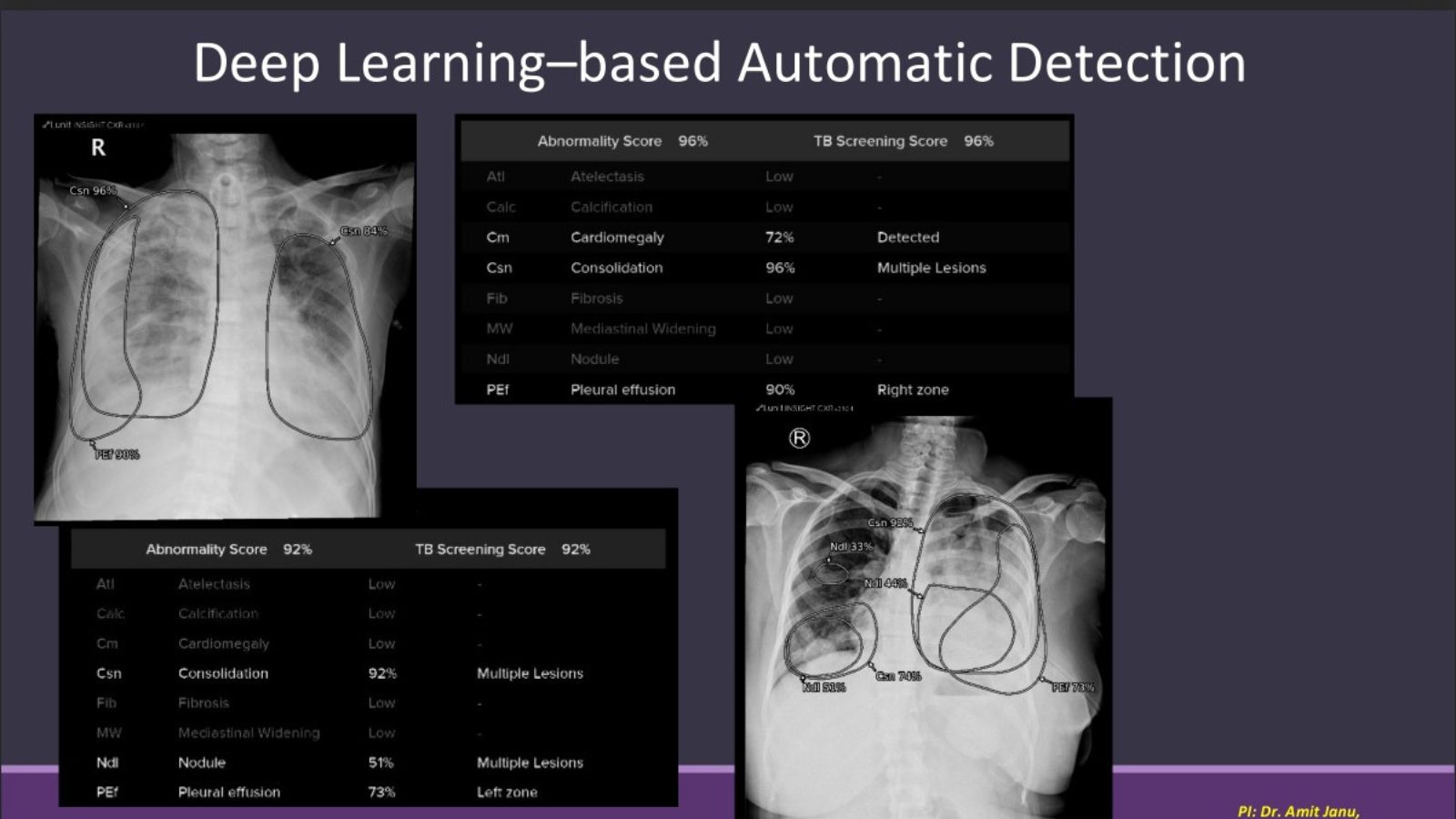 How AI can help detect cancer and why India’s biggest cancer treatment ...